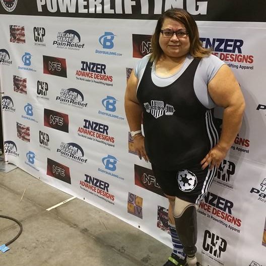 Entrepreneur, Athlete, Advocate, Amputee And Inspiration | Osprey Observer